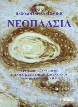 ΝΕΟΠΛΑΣΙΑ // ΓΕΝΙΚΗ ΠΑΘΟΛΟΓΙΚΗ ΑΝΑΤΟΜΙΚΗ - ΚΑΝΑΚΟΥΔΗΣ Γ. ΓΕΡΑΣΙΜΟΣ ...