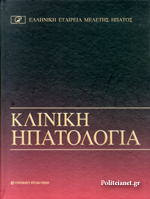 Κλινικη Ηπατολογια (σκληροδετη Εκδοση) - Συλλογικο - Βιβλιοπωλείο Πολιτεία